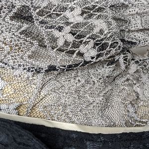 Ryu | Dresses | Ryu Lace Black And White Dress Nwt Jacket Crochet ...